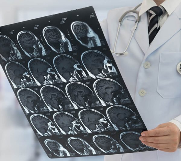 neurology testing – London Neurology & Pain Clinic